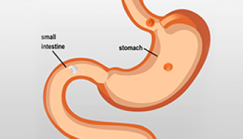 Ecotrin® Enteric Coated Tablets - OTC NSAID Aspirin Products